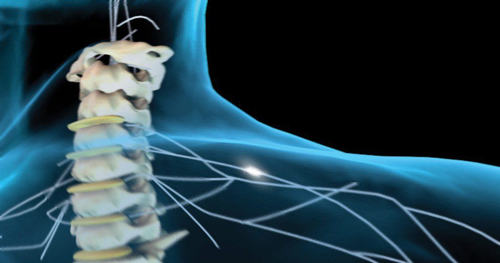 Remember to Schedule Your Spinal Screening • Southwest Florida's Health ...