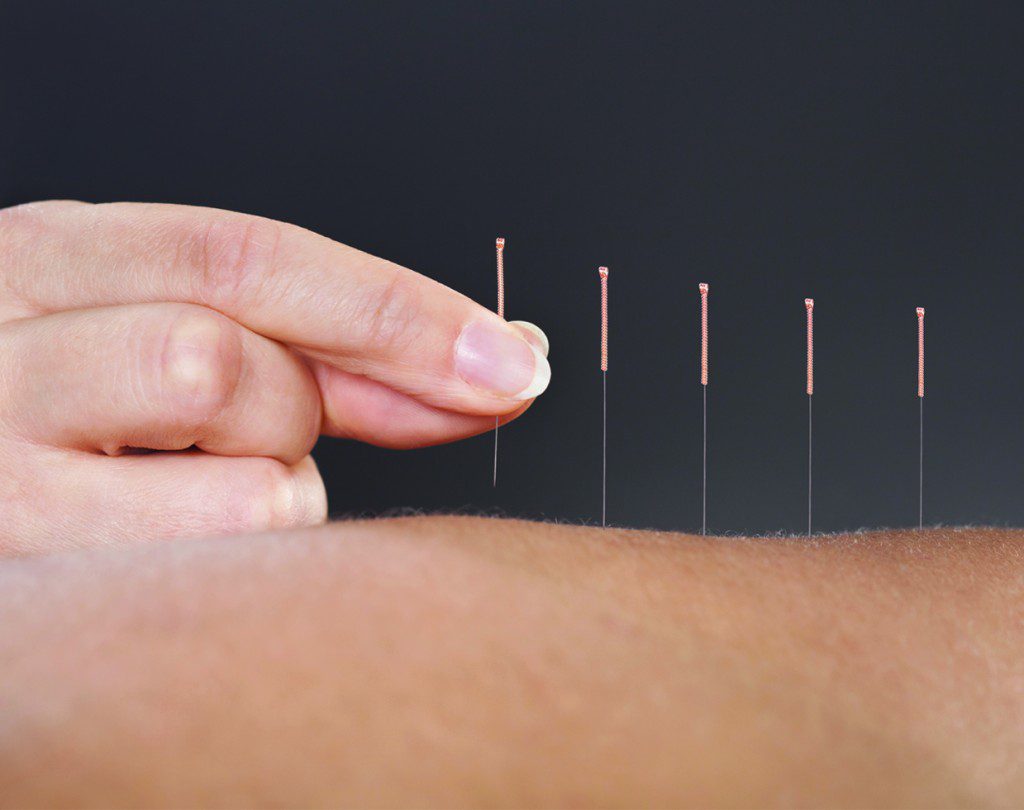 Treatment for Arthritis Sufferers! • Southwest Florida's Health and ...