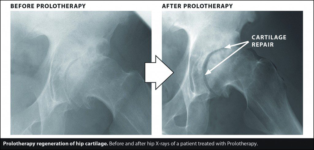 Hip Instability at the Core of Hip Pain conditions • Southwest Florida ...