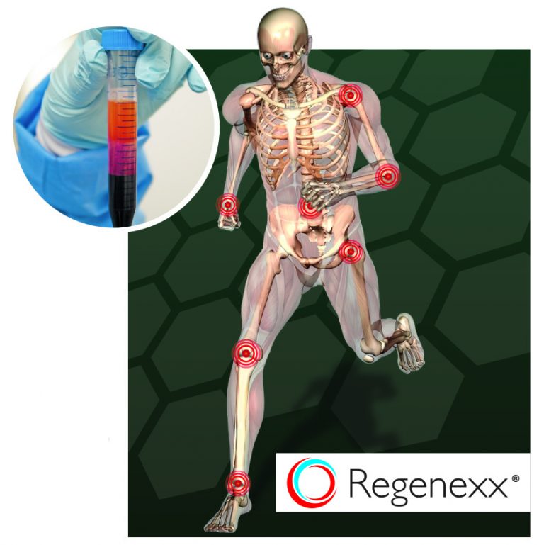 stem-cells-setting-the-new-standard-for-treatment-of-orthopedic ...