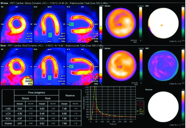 Collier County Take Heart: The most advanced non-invasive nuclear ...