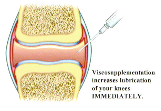 End Knee Arthritis Pain with FDA Approved Joint Injections • Southwest ...