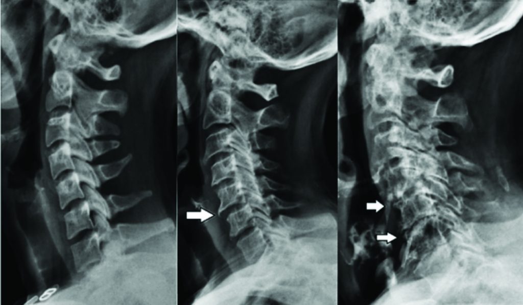 Check Your Neck! • Southwest Florida's Health and Wellness Magazine