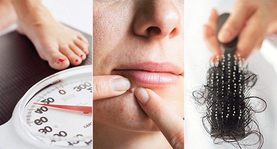 Could You Have Undiagnosed PCOS? Warning Indicators You Should Know ...