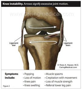 Prolotherapy: The Regenerative Treatment for Arthritic Joints ...