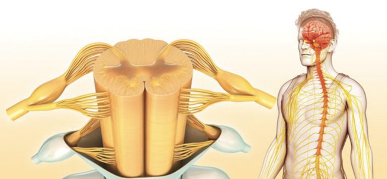 Lumbar Radiculopathy (Nerve Root Compression) • Southwest Florida's ...