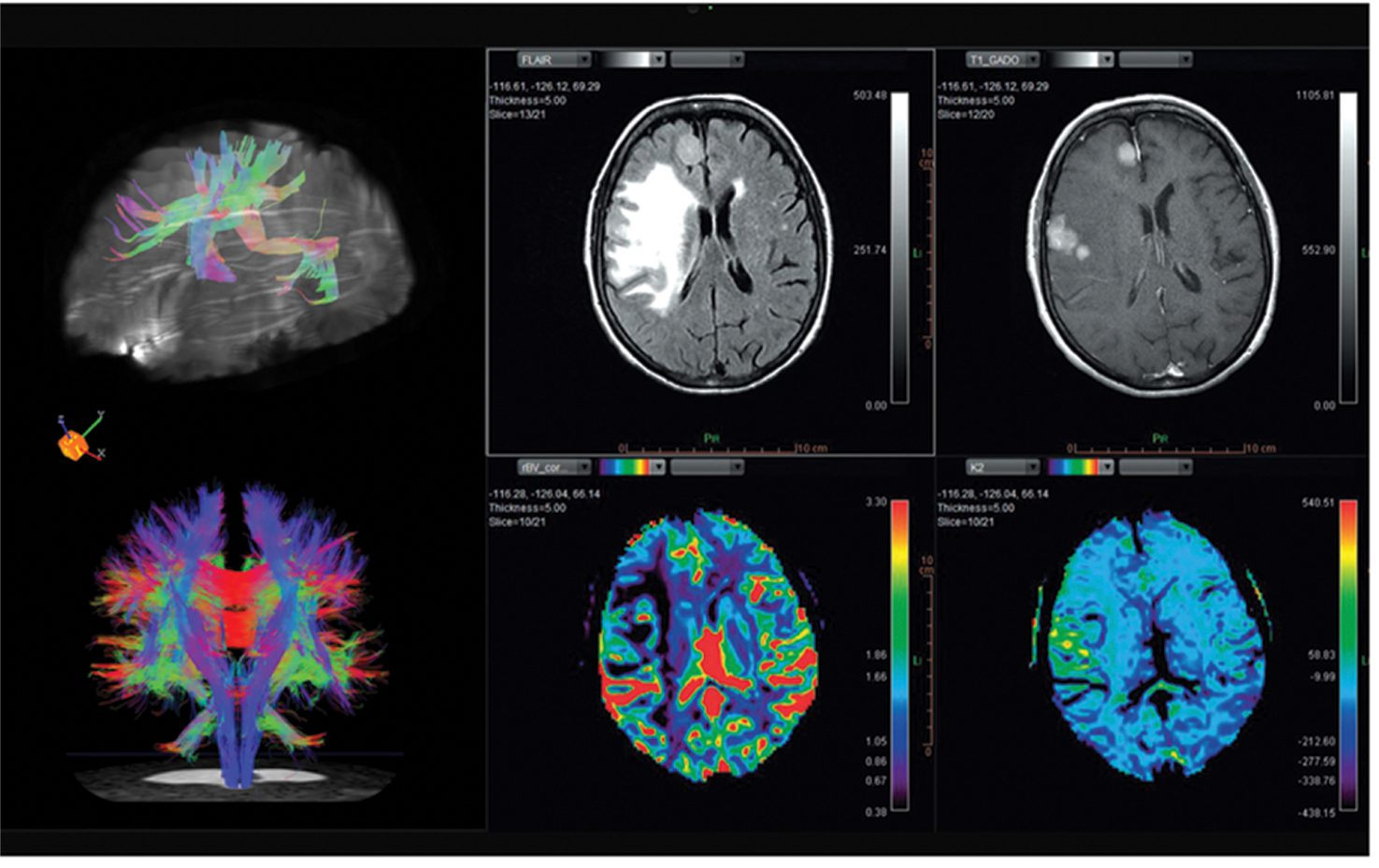 Advanced Technology at SIR Revolutionary CT and 3T MRI • Southwest ...