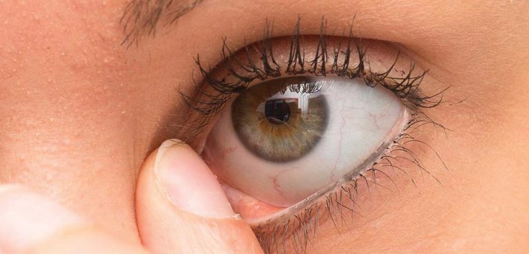 Spa Scrubs an innovative treatment that eases the pain of blepharitis ...