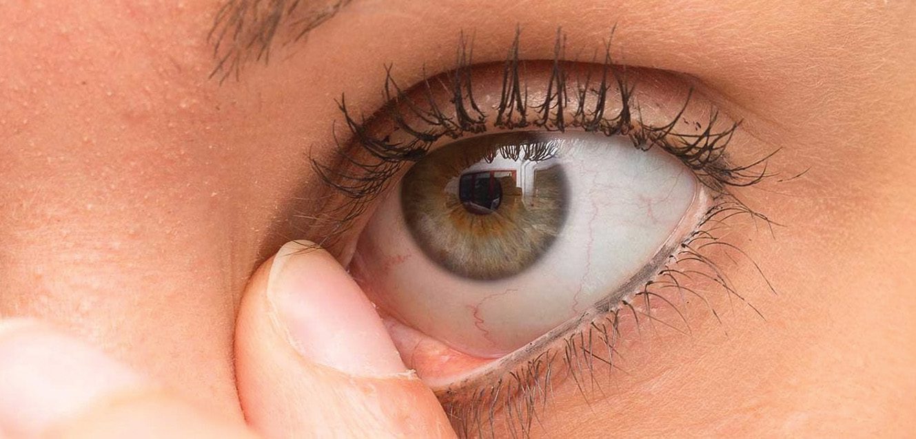 Spa Scrubs an innovative treatment that eases the pain of blepharitis ...