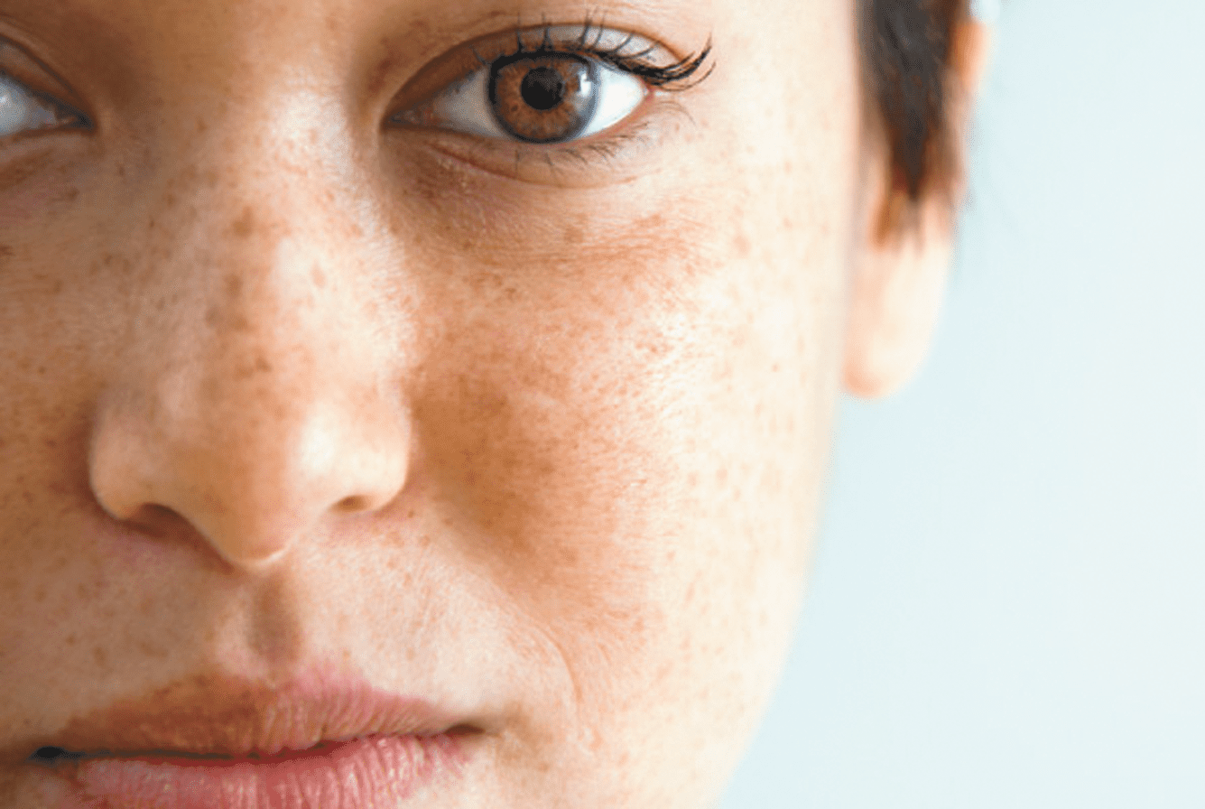 Let’s talk about pigment! • Southwest Florida's Health and Wellness ...