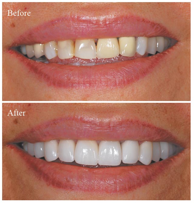 AACD Accreditation - What is it and Who has it? • Southwest Florida's ...