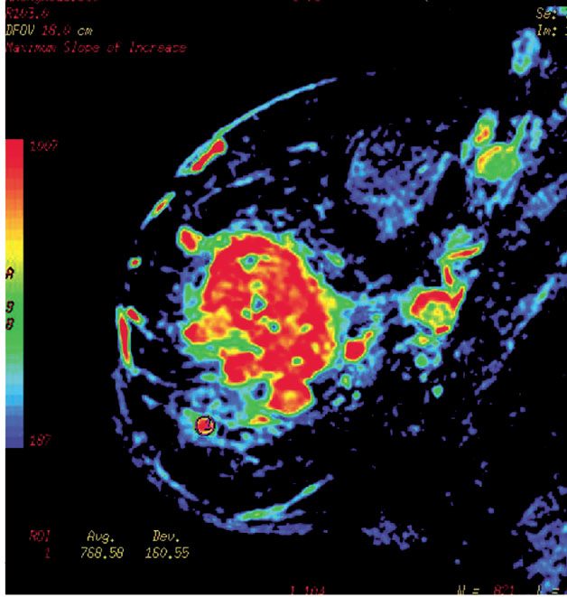 ProScan Raises the Bar of Women's Health Care with NCH • Southwest ...