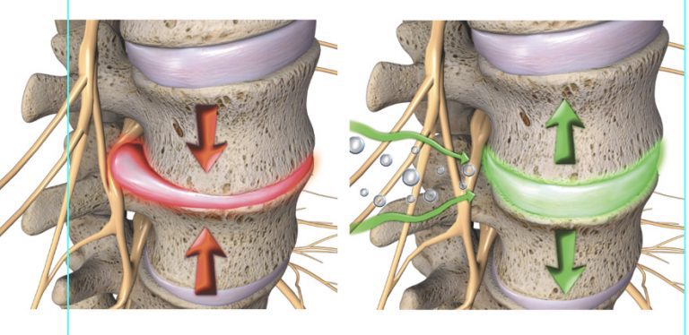 When Negative is Positive • Southwest Florida's Health and Wellness ...