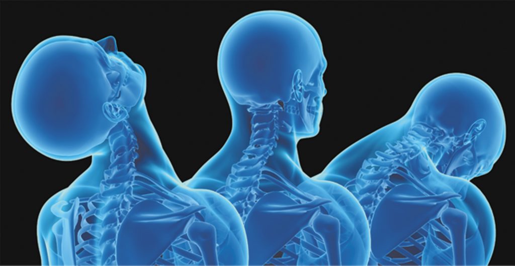 Understanding Spinal Injuries • Southwest Florida's Health and Wellness ...