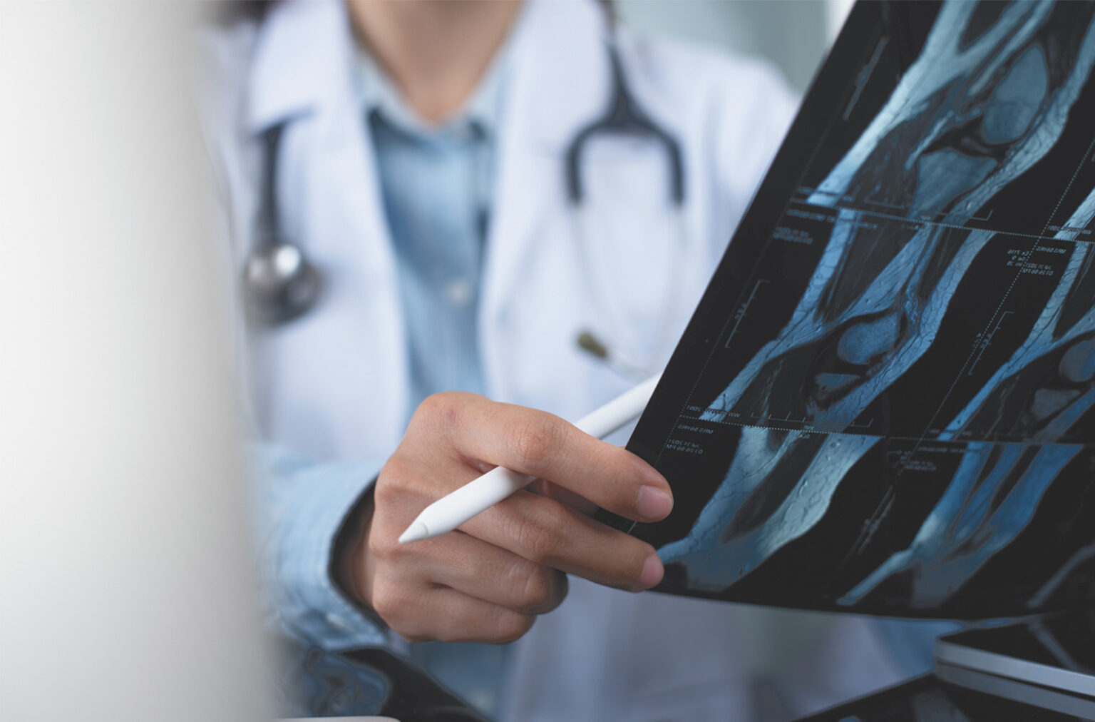 MRI vs EMG which is more accurate? • Southwest Florida's Health and ...