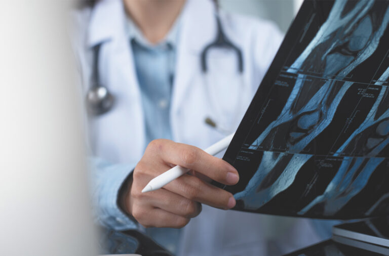 MRI vs EMG which is more accurate? • Southwest Florida's Health and ...