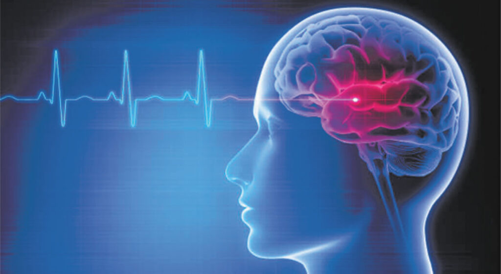 BAHI Therapy: A Holistic Protocol for Post-Stroke Brain Recovery ...