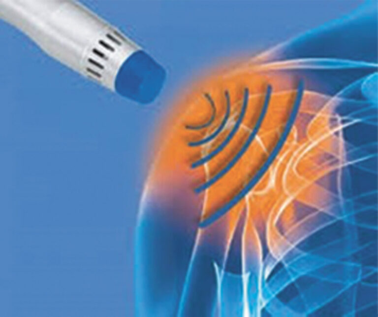 Shockwave Therapy: A Non-Surgical Solution for Rotator Cuff Injuries ...